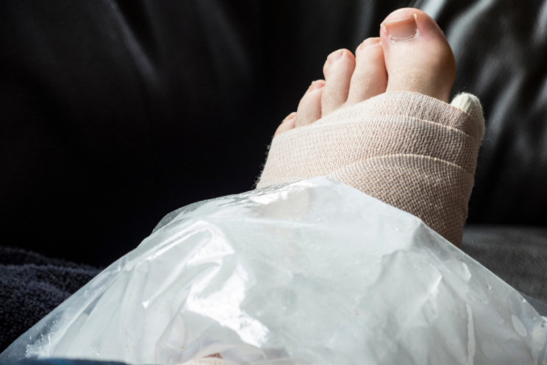 What to Expect After Ankle Replacement Surgery - Coastal Orthopedics